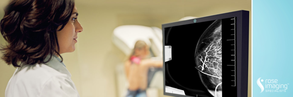 Ductography - Rose Imaging Specialists